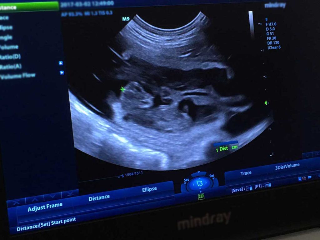 Ultraljud - Karin & Staffan Veterinär AB